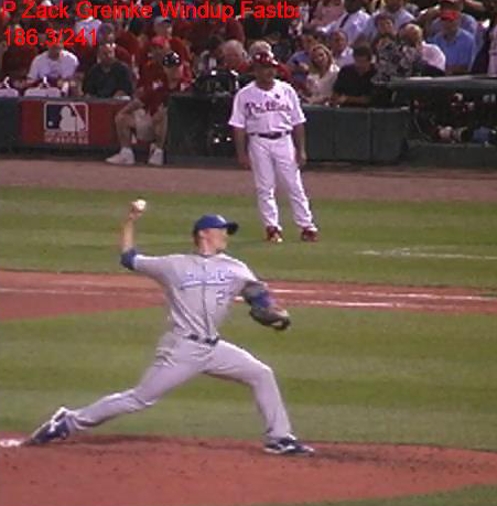 Identifying Leaks in the Delivery - Knee at First Foot Strike • RPP ...