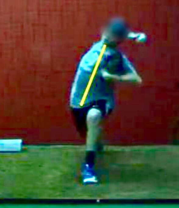 3 Reasons for Lower Back Pain after Pitching • RPP Baseball
