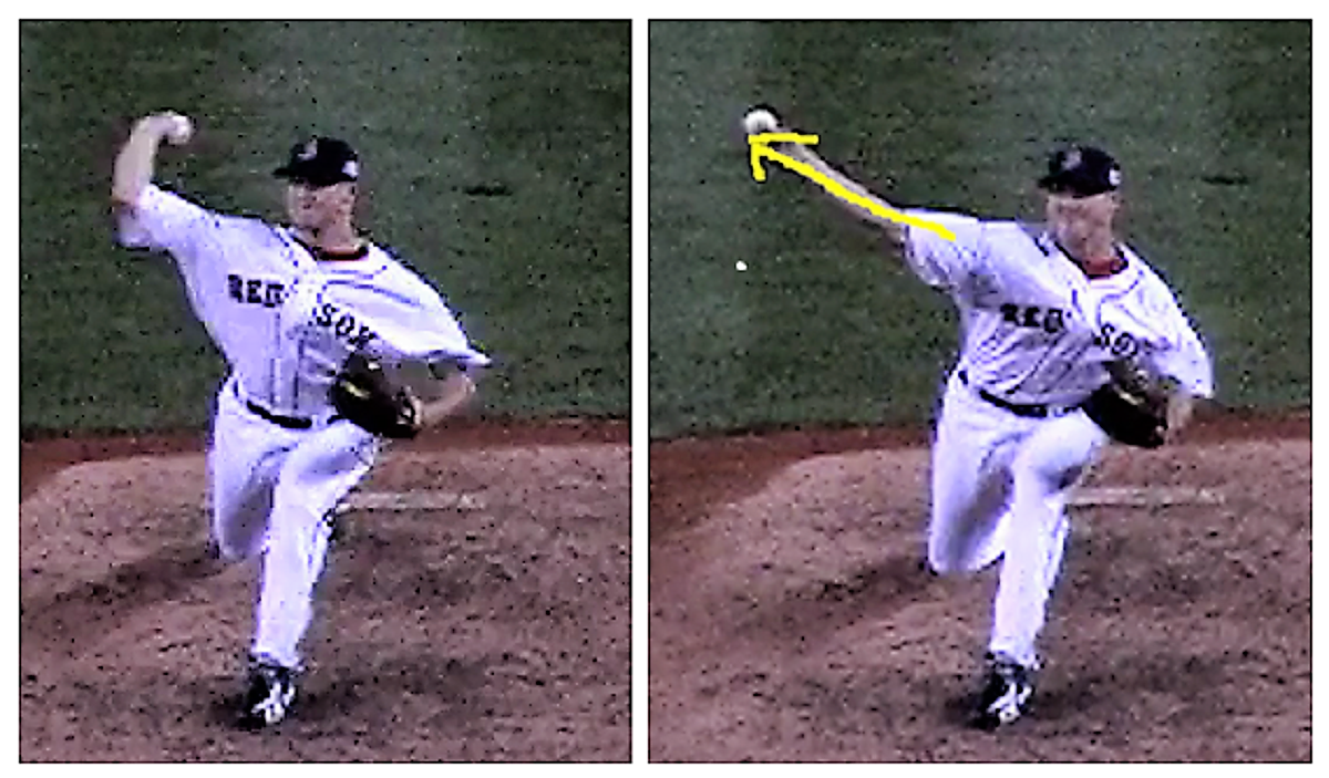 Addressing and Treating Trunk Tilt at Foot Strike - Part 2 • RPP Baseball