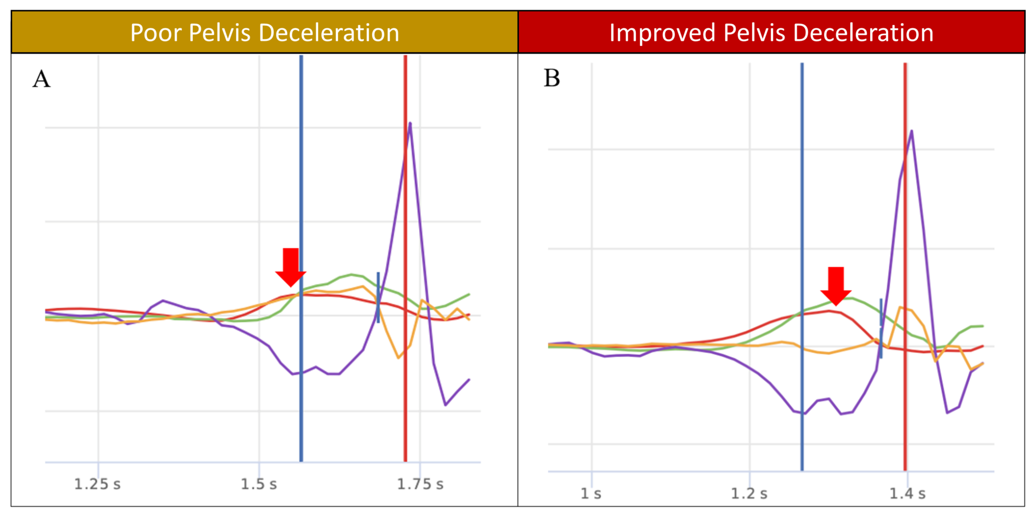 Pitching Biomechanics: 3 Factors in Kinematic Sequence • RPP Baseball